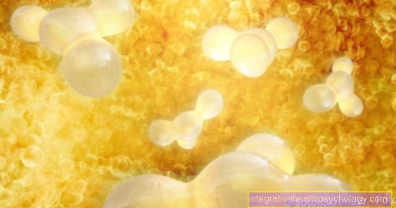 LIPOOM IN DE BORST - DERMATOLOGIE-ONLINE