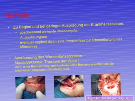 SCOTOMA - OOGHEELKUNDE