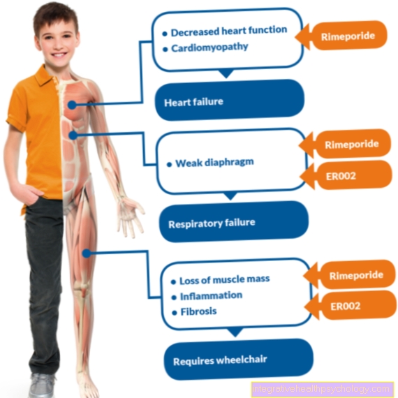 DUCHENNE SPIERDYSTROFIE - NEUROLOGIE-ONLINE